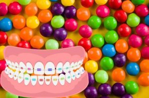 Can You Eat Skittles With Braces? (All You Need to Know)